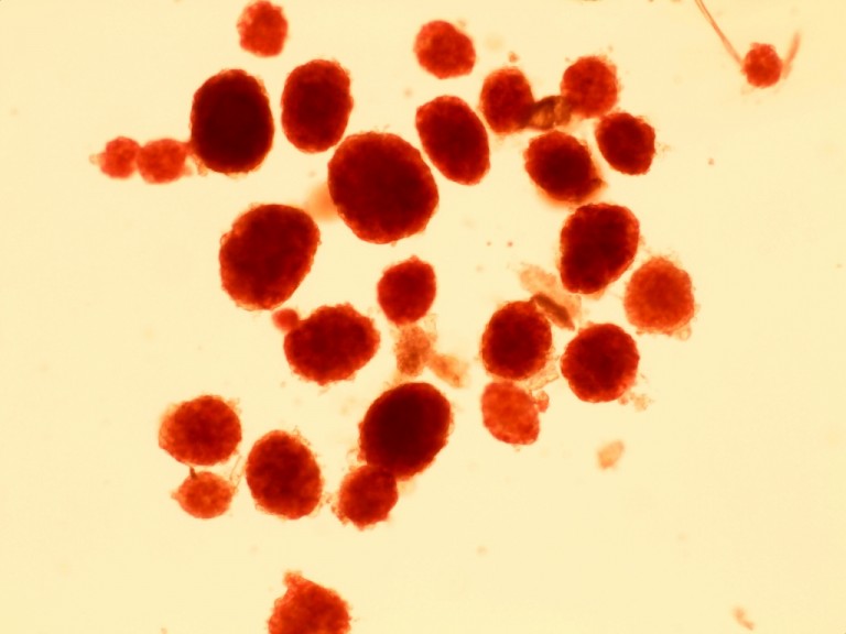 Human Islets for Research (HIR) | Prodo Labs